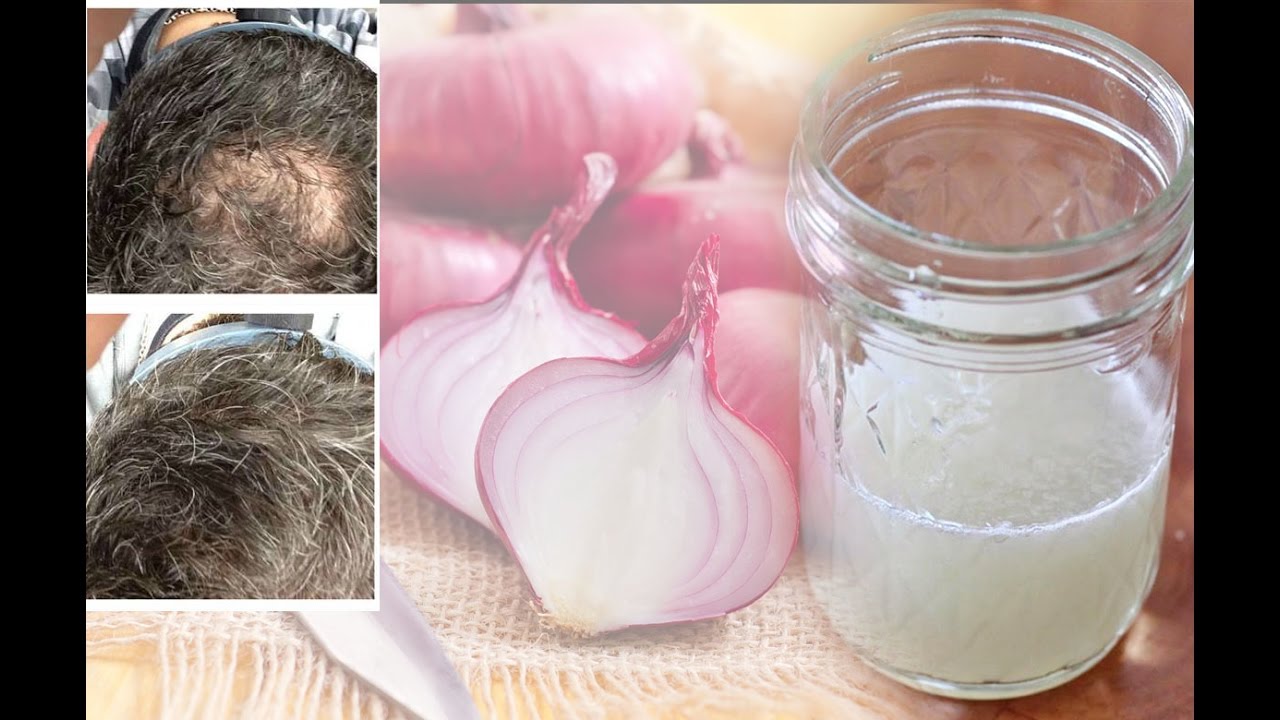 onion juice | FabWoman