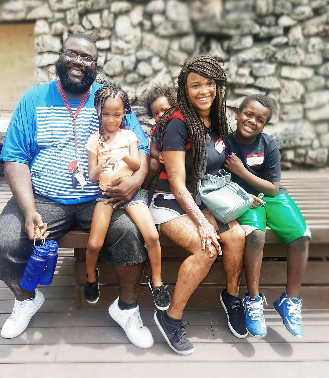 Kanisha Anthony Burn Survivor Shares Inspirational Message