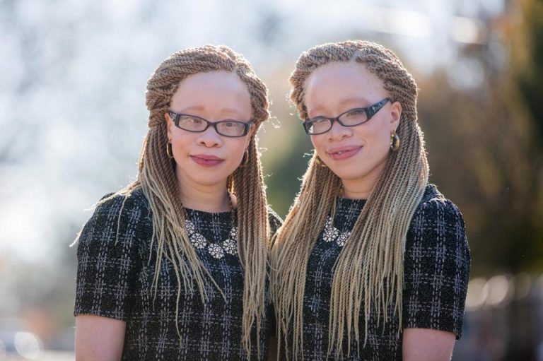 Nigerian Albino Twins Take Over Fashion World In US | FabWoman